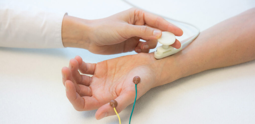 Elektromyographie und Elektroneurographie – Neurologie.Psychiatrie ...